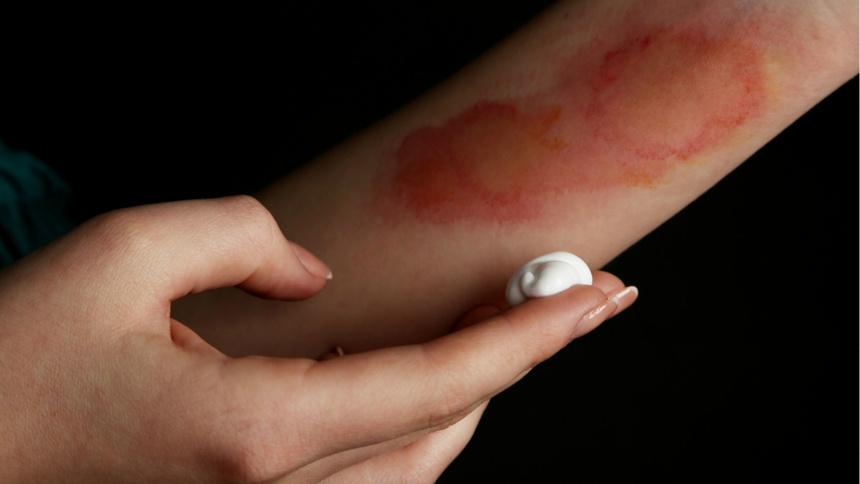 Bien soigner les plaies | vitagate